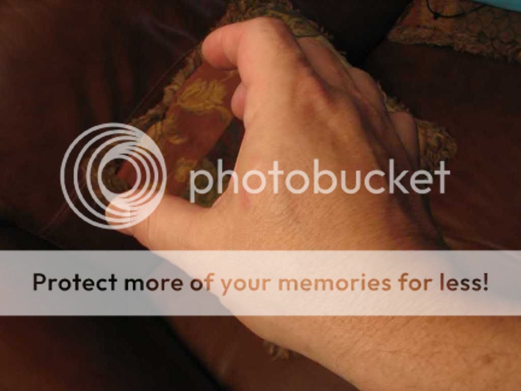 hammer bite? - Calguns.net